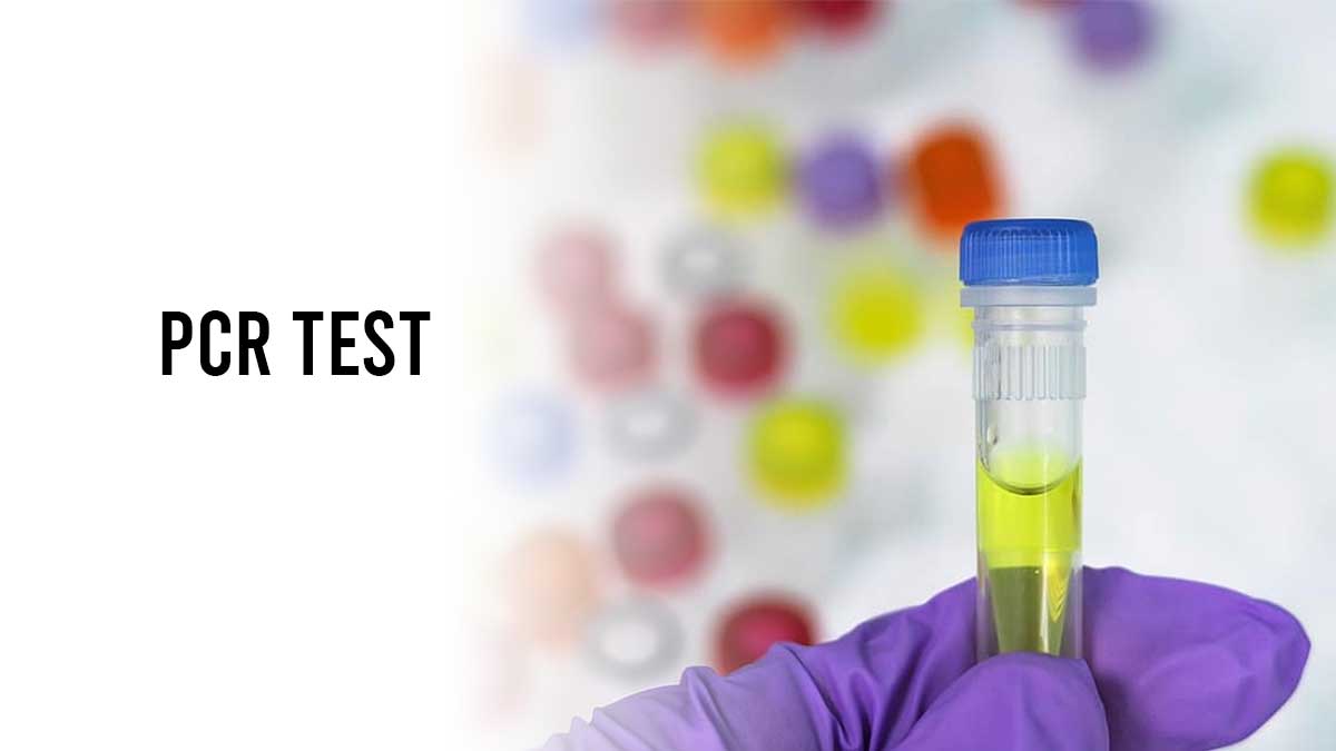 Repeat negative RT-PCR test within 10 days doesn't override first ...